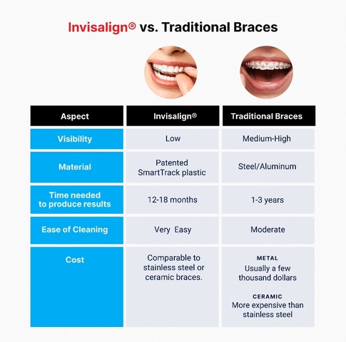 Invisalign in Arcadia, CA - Bracetime